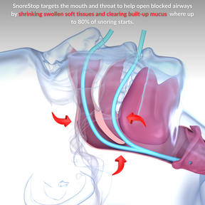 SnoreStop Anti-Snoring Breathe Easy Formula